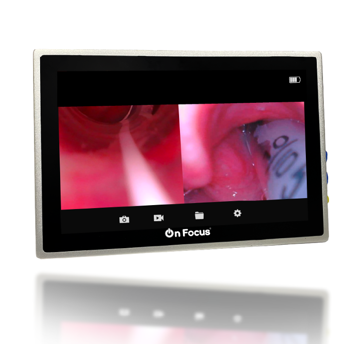 OnFocus DUO | Onfocus Global